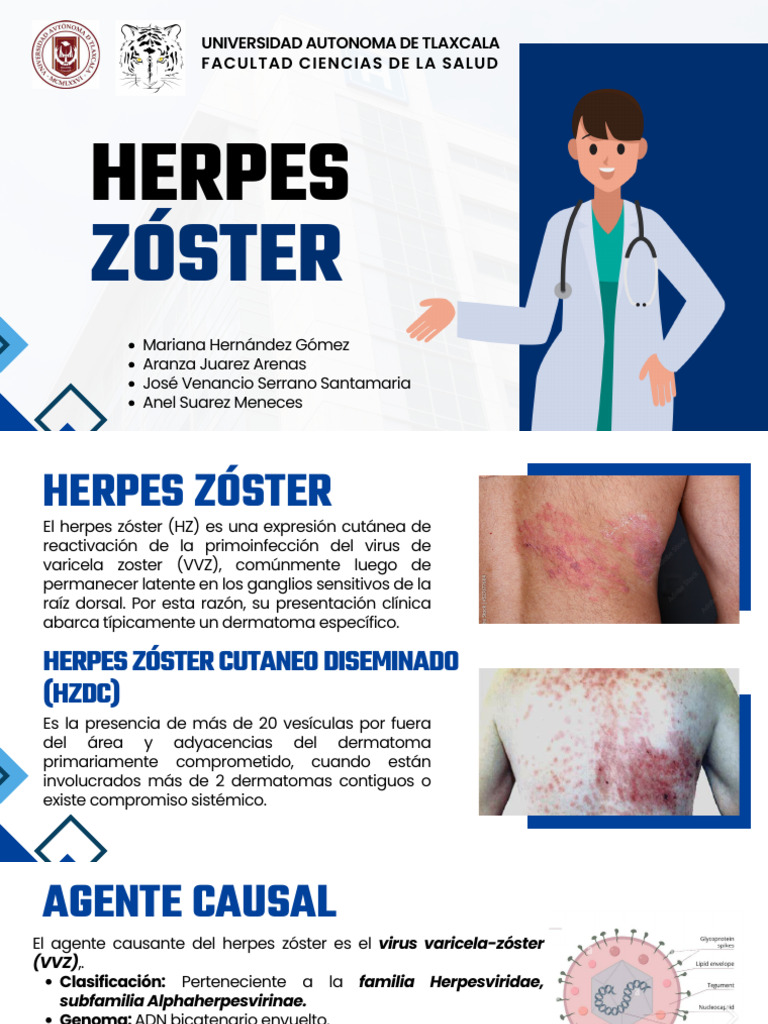 Herpes Zóster: Causas y Tratamiento | PDF | Virus | Medicina