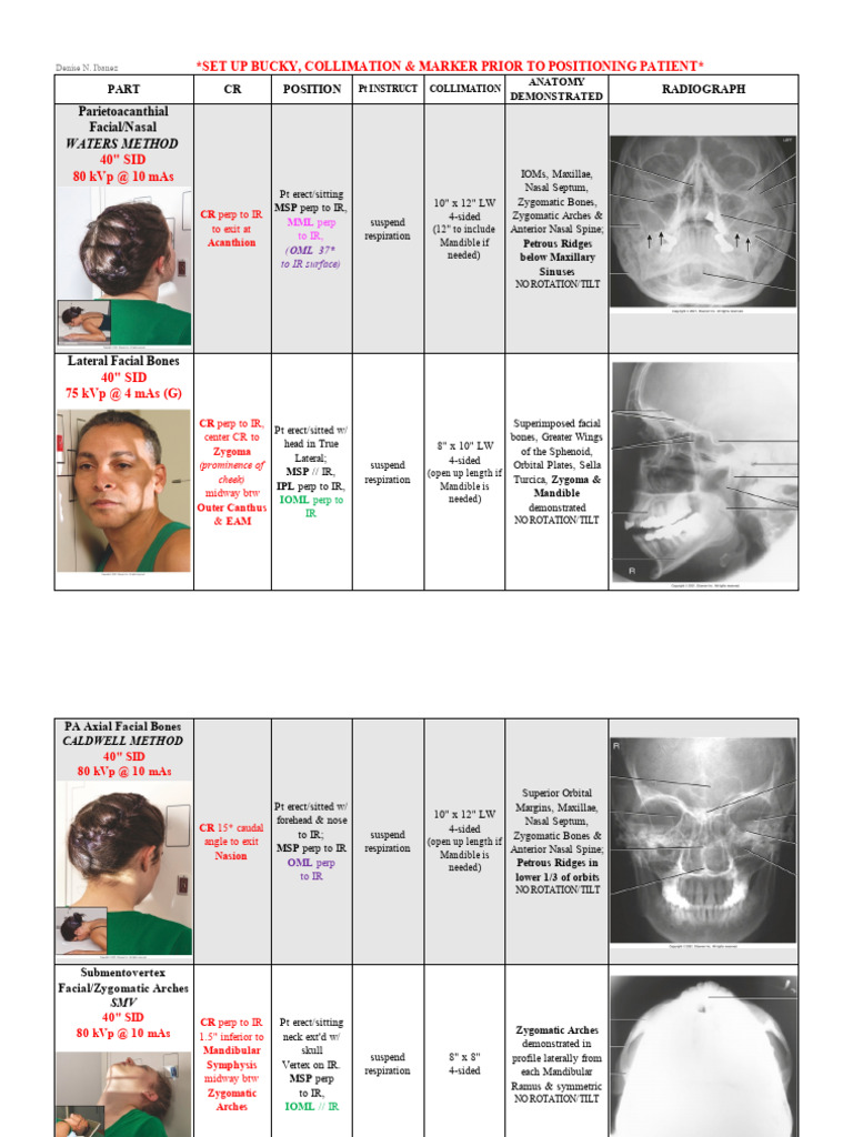 Facial Bones With AP Towne | PDF | Human Nose | Human Head And Neck