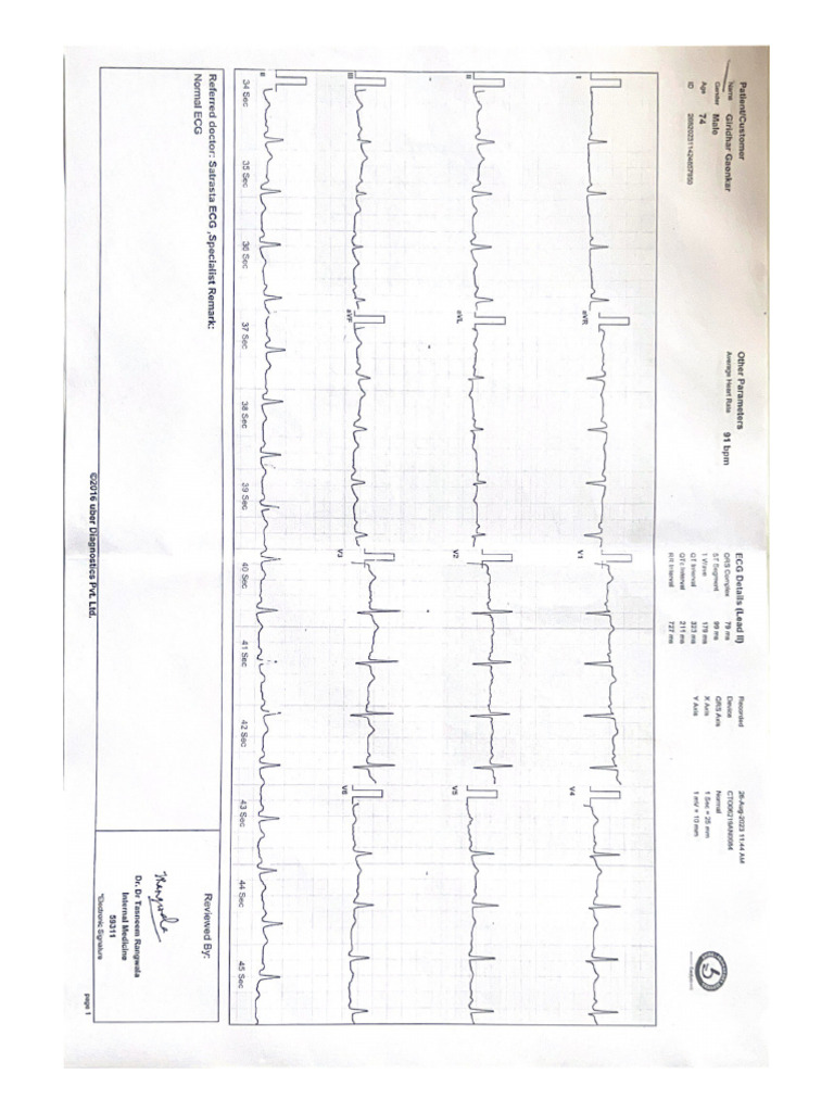 Ecg Details | PDF