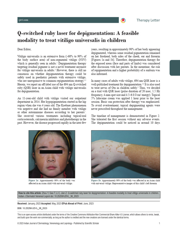 Q-Switched Ruby Laser For Depigmentation A Feasibl | PDF | Dermatology ...