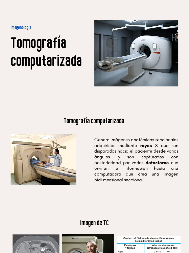 Tomografía Computarizada: Técnicas y Usos | PDF | Ct Scan | Imagenes ...