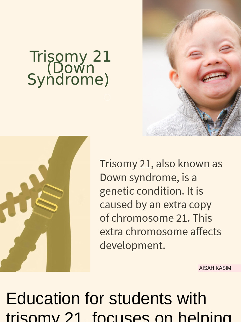 Understanding Trisomy 21 A Comprehensive Overview | PDF