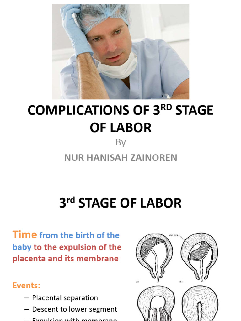 Complications of 3 Rd Stage of Labor | PDF | Childbirth | Uterus
