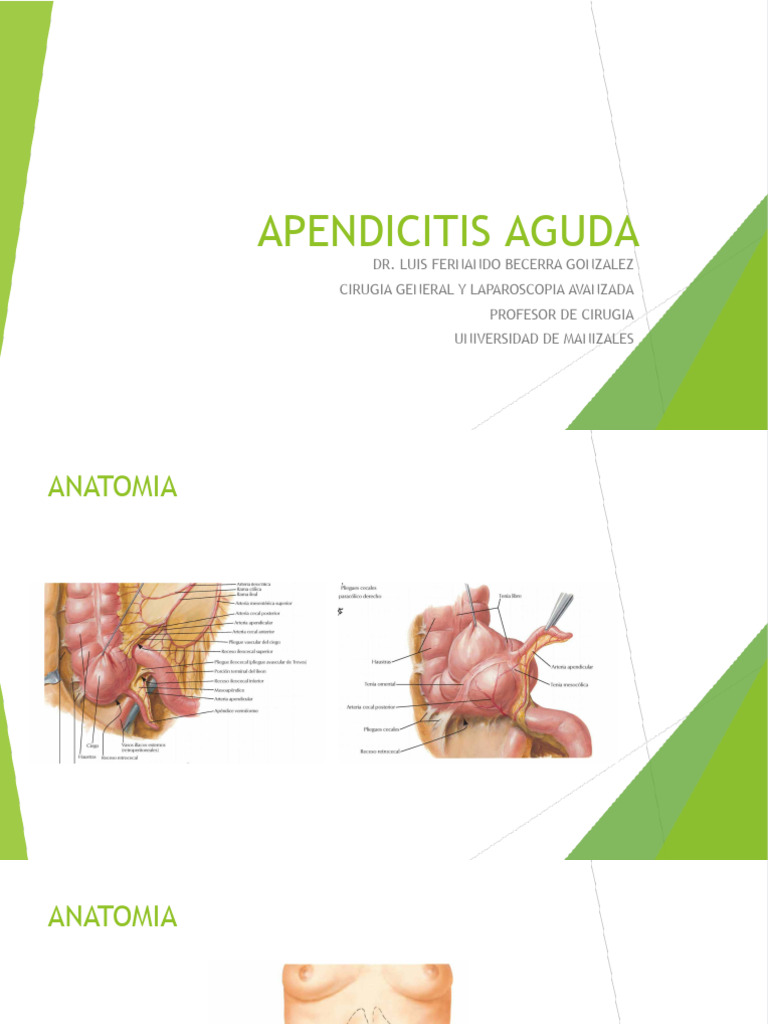 Apendicitis Aguda 2023 | PDF