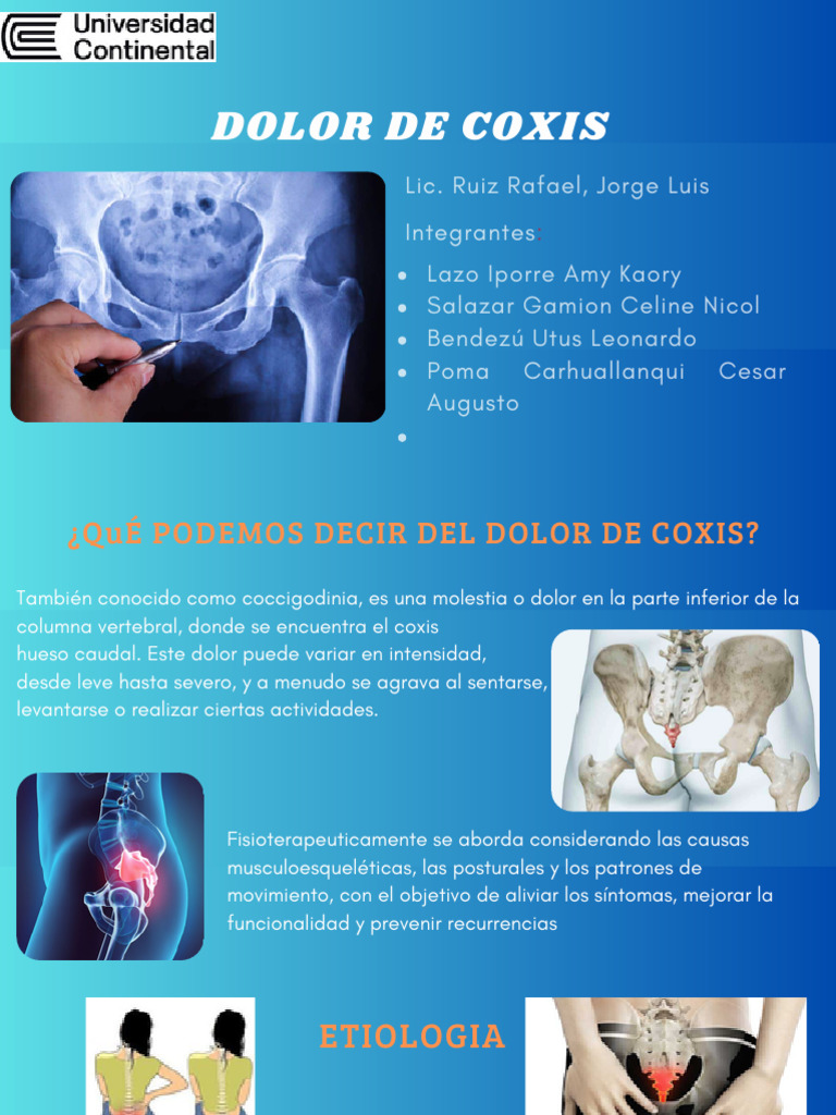 Dolor de Coxis | PDF | Artritis | Dolor