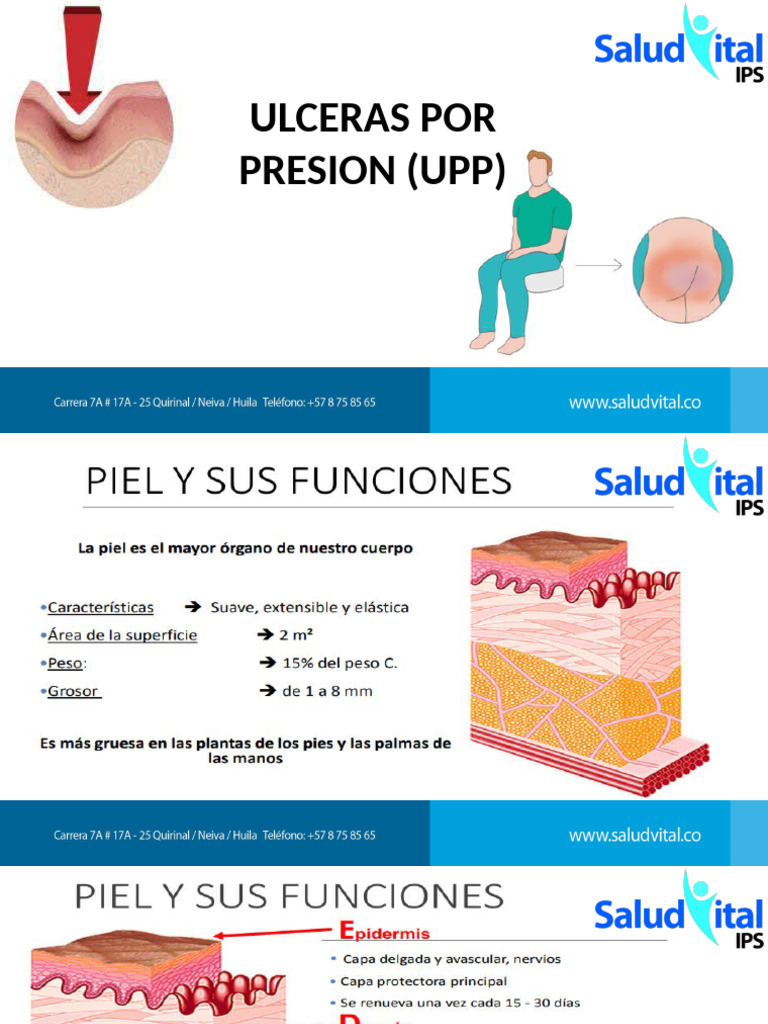 Manejo de Ulceras Por Presion | PDF