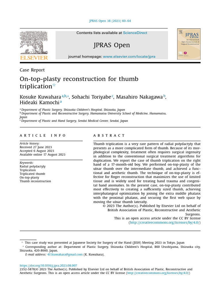 On-Top-Plasty Reconstruction For Thumb Triplication | PDF | Thumb | Limbs (Anatomy)