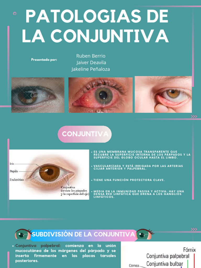 PATOLOGIAS DE LA CONJUNTIVA | PDF | Epitelio | Especialidades Medicas