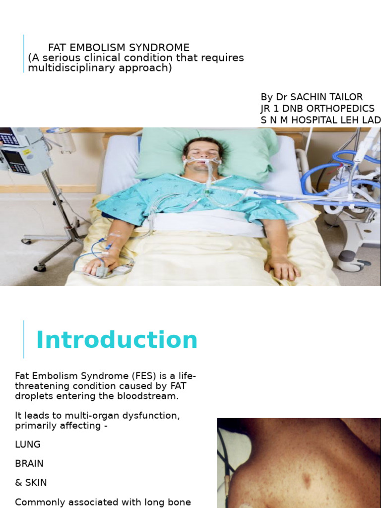 Fat Embolism Syndrome Detailed A 3 | PDF | Medical Specialties ...