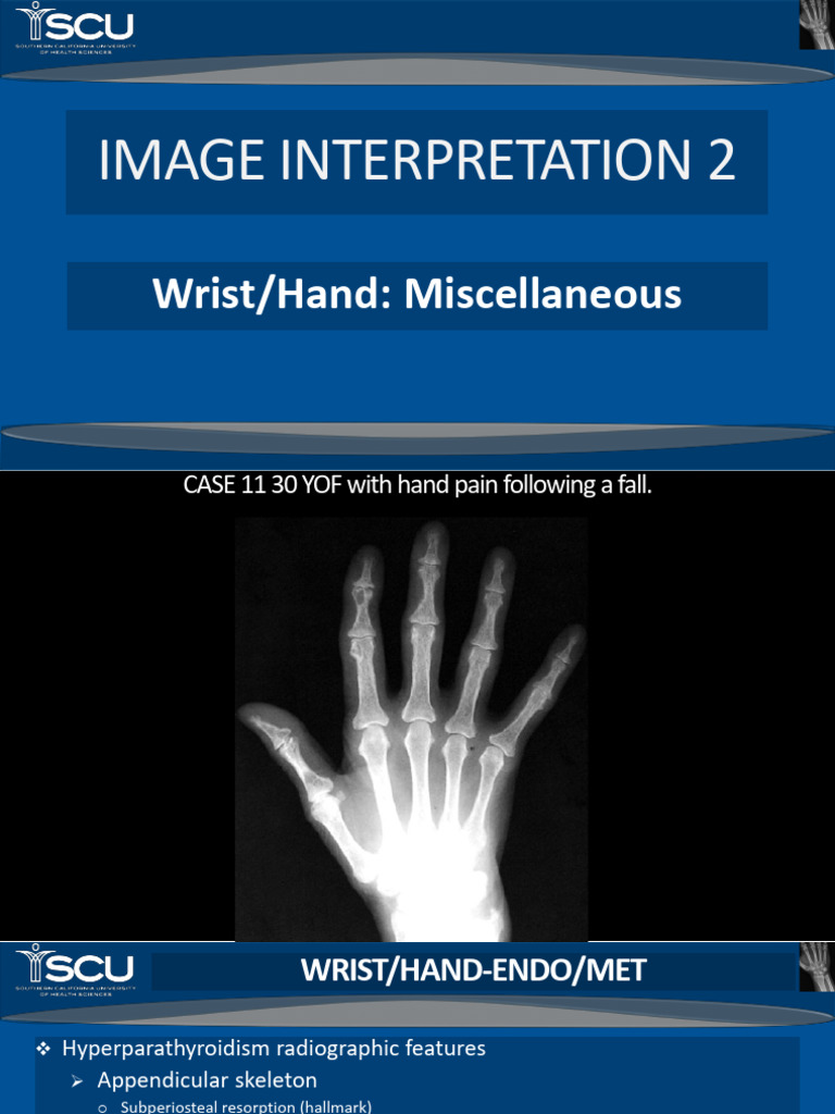 Hand and Wrist Disorders Overview | PDF | Hand | Bone