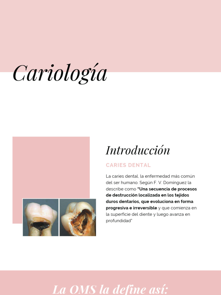 Causas y Clasificación de Caries Dental | PDF | Diente | Boca