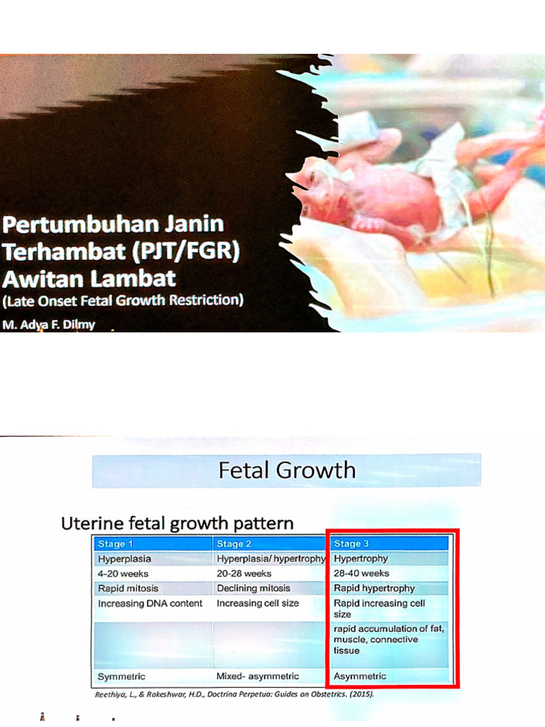 IUGR-late Onset-Dr - Dido | PDF