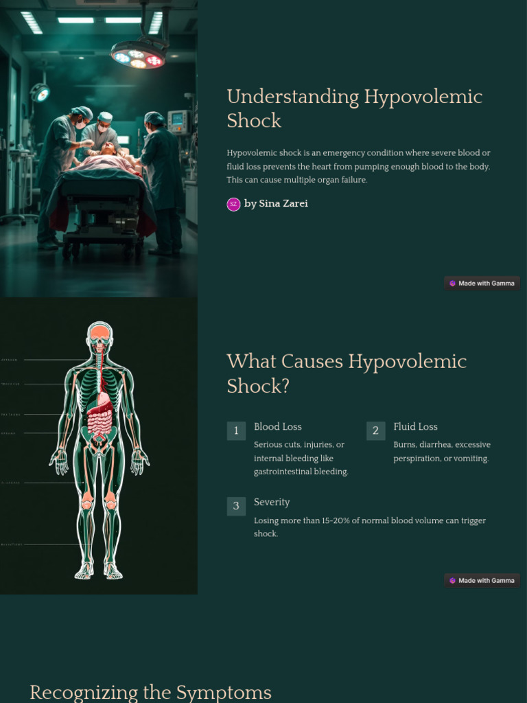 Understanding Hypovolemic Shock | PDF | Shock (Circulatory) | Heart