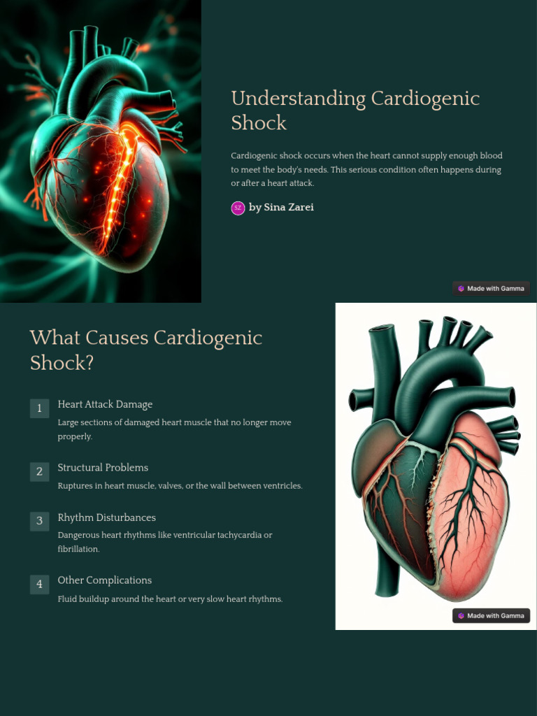Understanding Cardiogenic Shock | PDF | Heart | Myocardial Infarction