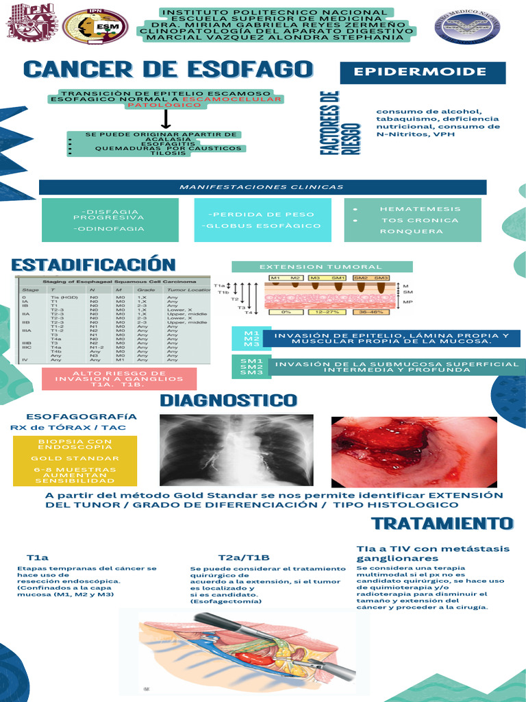 CANCER DE ESOFAGO | PDF | Cáncer de esófago | Cáncer