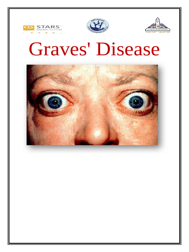 Graves' Disease Presentation | PDF | Hyperthyroidism | Thyroid