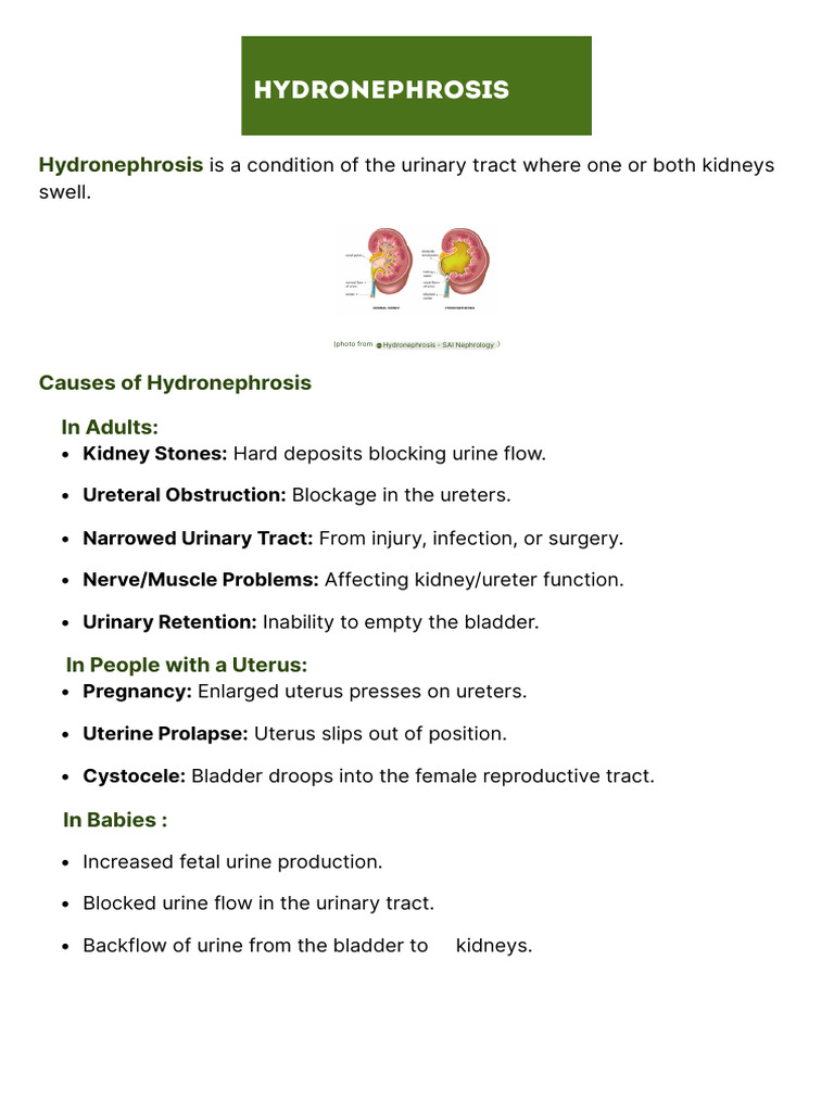 Understanding Hydronephrosis Causes & Treatment | PDF