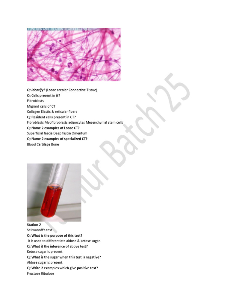 OSPE Compiled Shift 2 Batch'25 | PDF