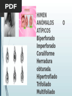 Tipos de himen y sus características | PDF