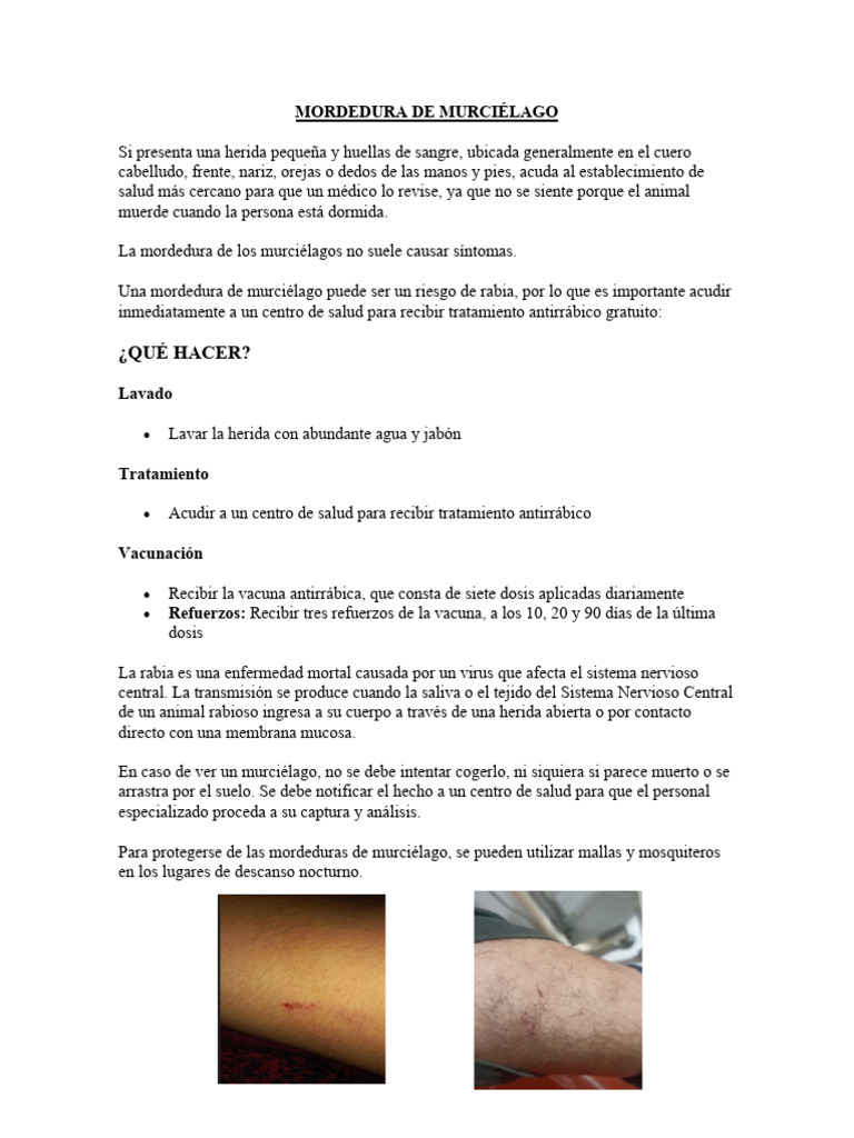 Prevención y tratamiento de mordedura de murciélago | PDF