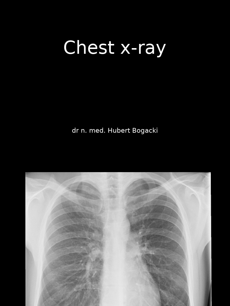 Prezentacja Klatka Piersiowa Rtg-Kopia | PDF