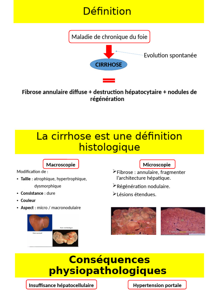 Cirrhose Cours | PDF | Cirrhose | Maladies et troubles humains