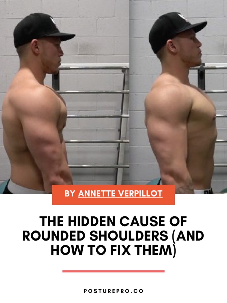 The Hidden Cause of Rounded Shoulders and How To Fix Them 2025 | PDF ...