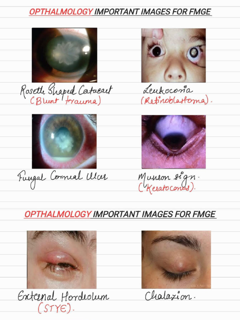 Important Ophthalmology Images | PDF