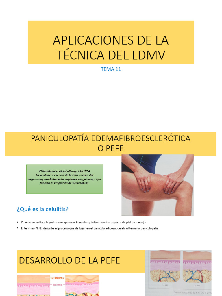 Paniculopatía: Definición y Fases PEFE | PDF | Especialidades Medicas ...