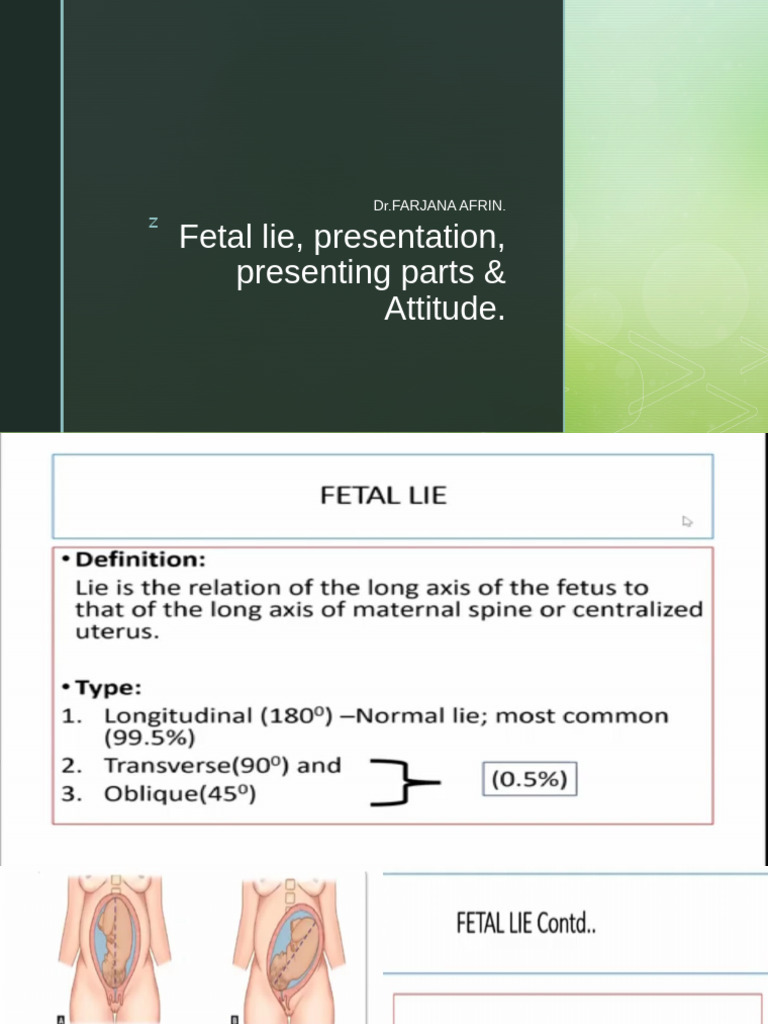 Fetal Lie, Presentation, Presenting Parts & Attitude.: DR - Farjana ...