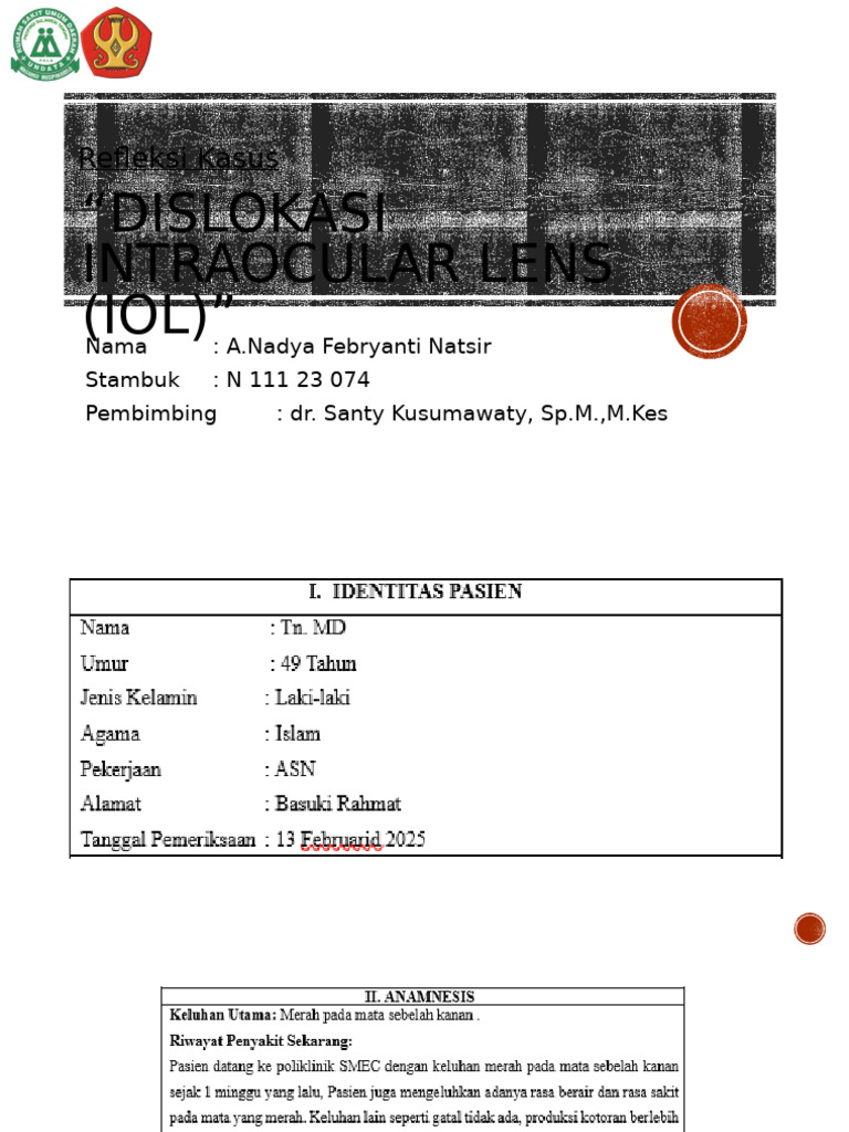 Ppt_refka Mata Nad | PDF