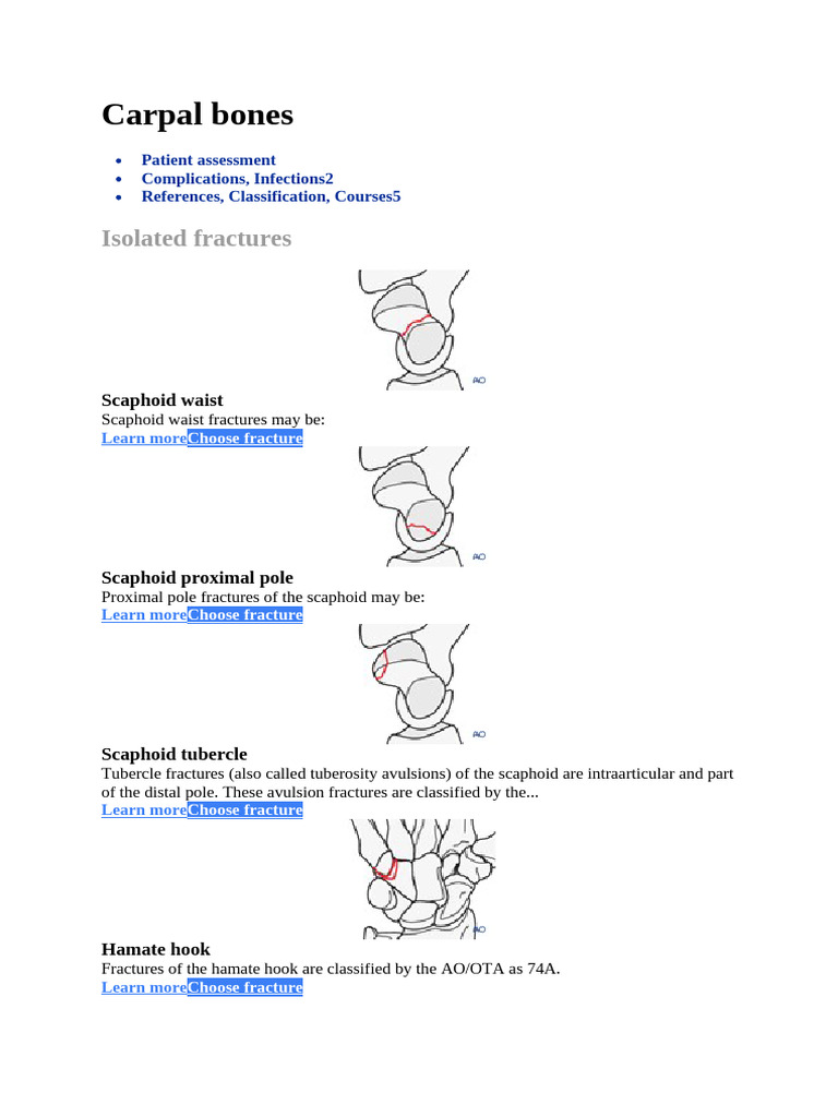 Comprehensive Guide to Carpal Bone Injuries | PDF