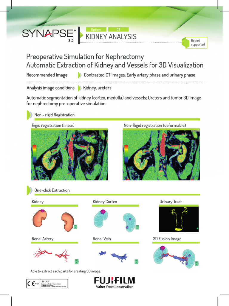 Kidney Analysis - V5.2 MP - r1 13 08 19 | PDF | Kidney | Urology