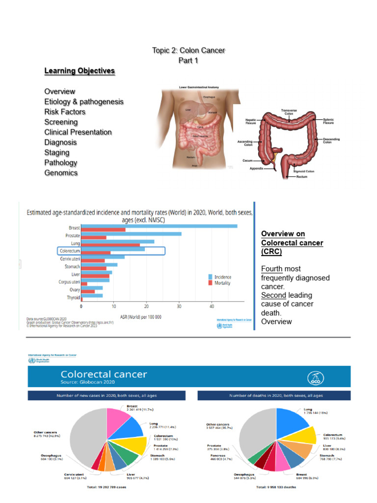 Colon Cancer Part 1 | PDF | Colorectal Cancer | Cancer