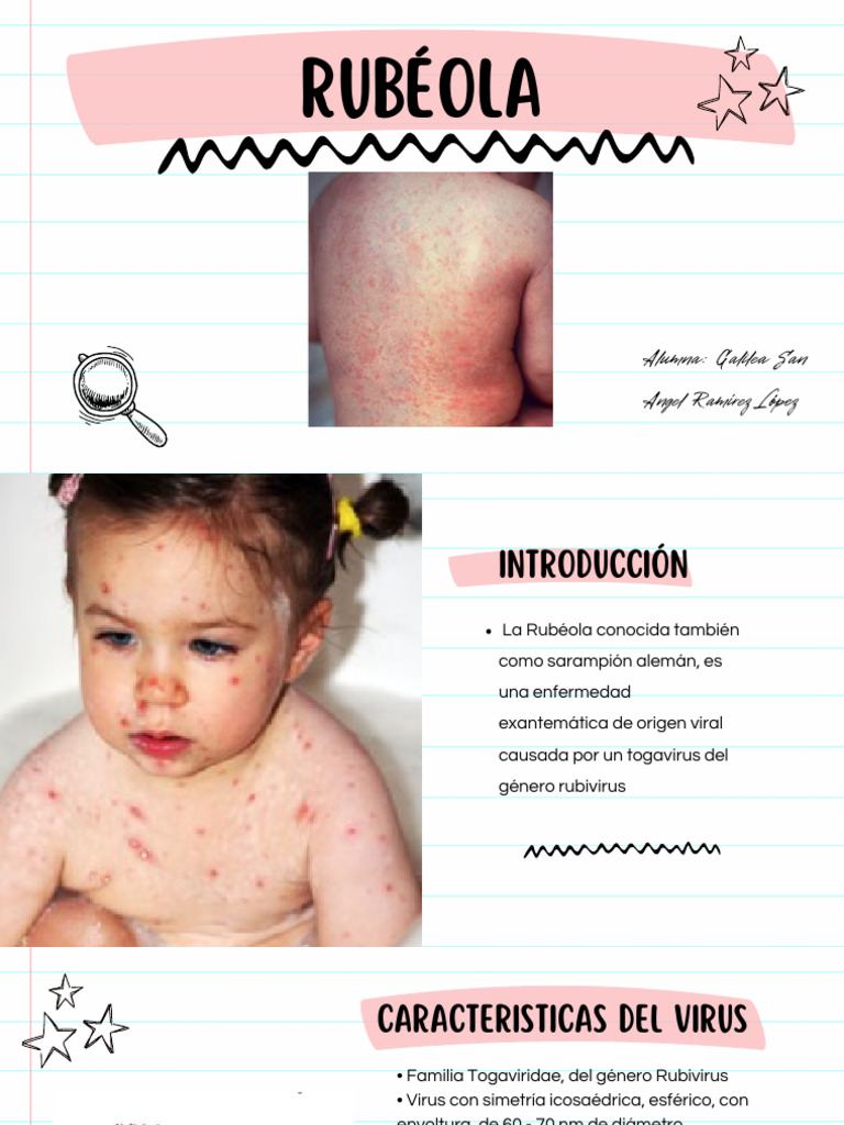 Rubéola | PDF | Virus | Sarampión