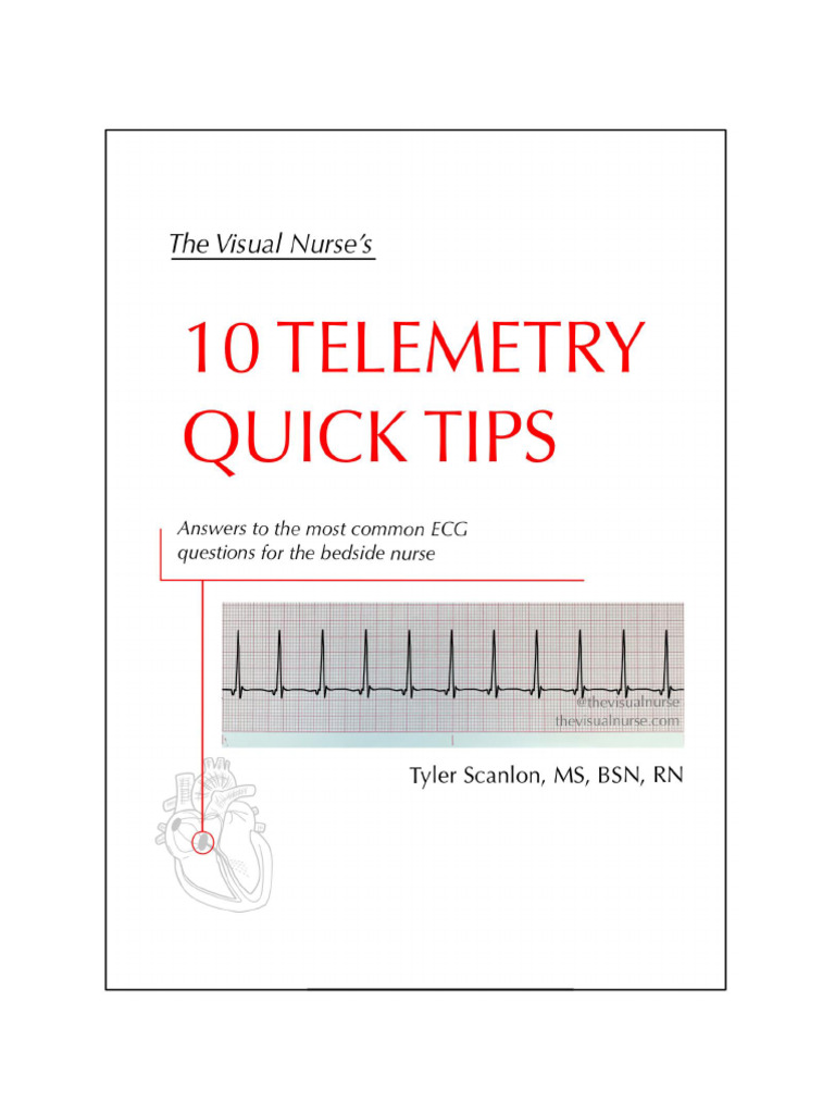 10 Telemtry Quick Tips Ebook | PDF | Atrium (Heart) | Heart