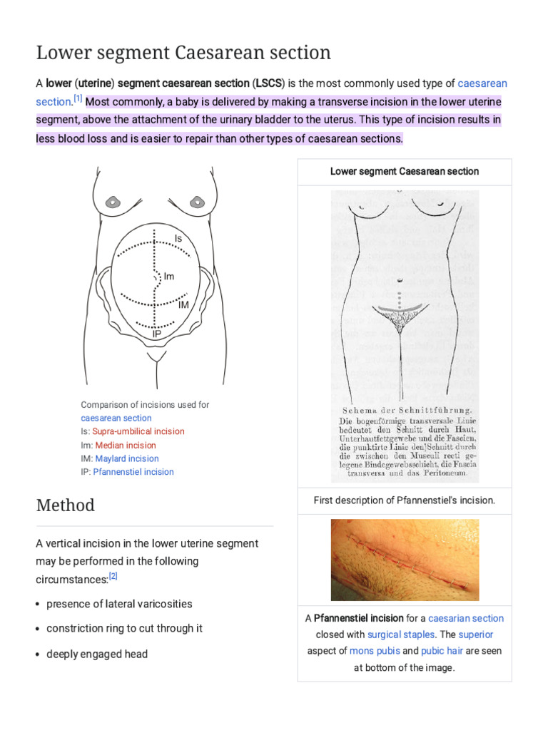 Lower segment Caesarean section - Wikipedia (1) | PDF | Medical Specialties