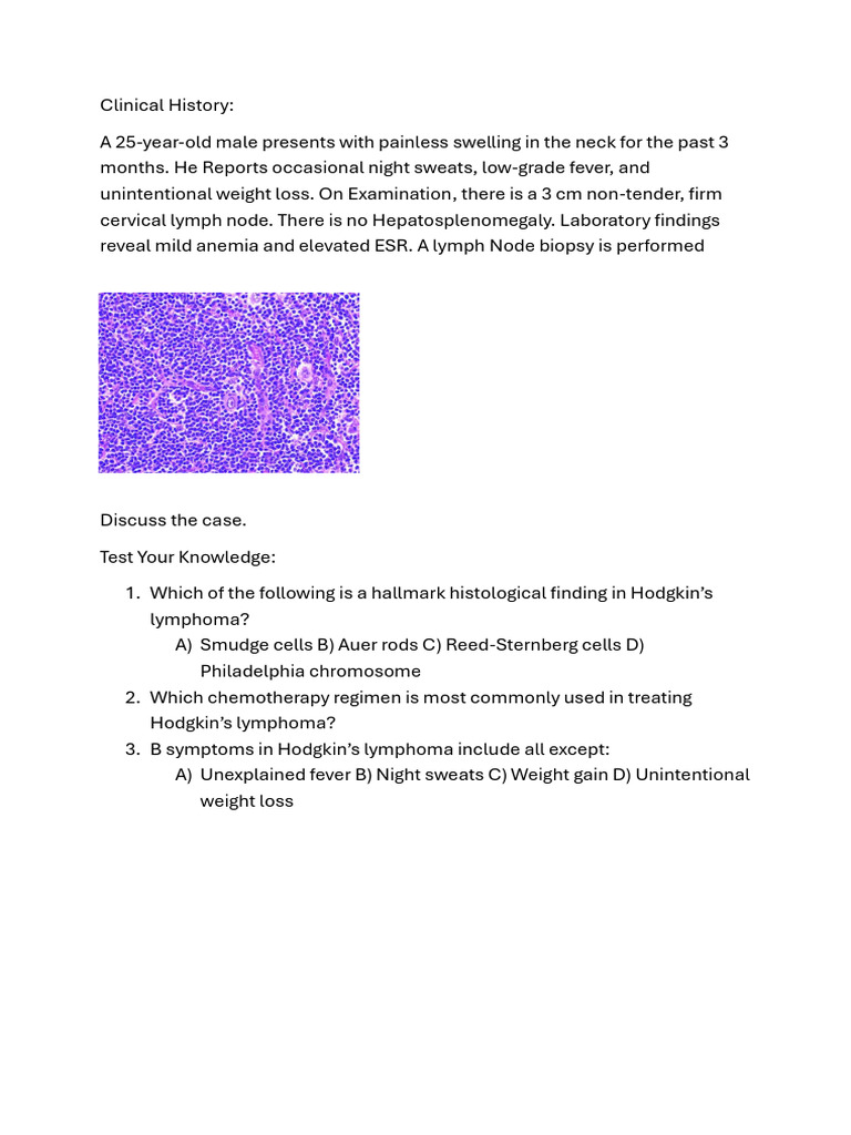 Hodgkin's Lymphoma (Case History) | PDF