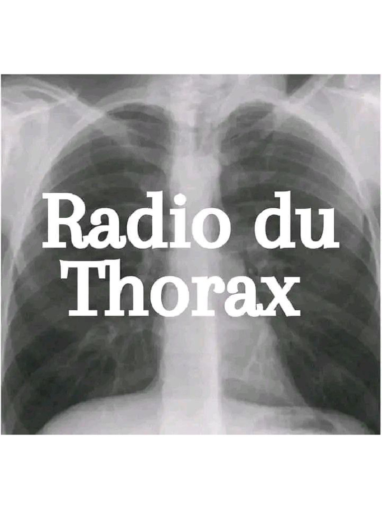 Radio de thorax | PDF