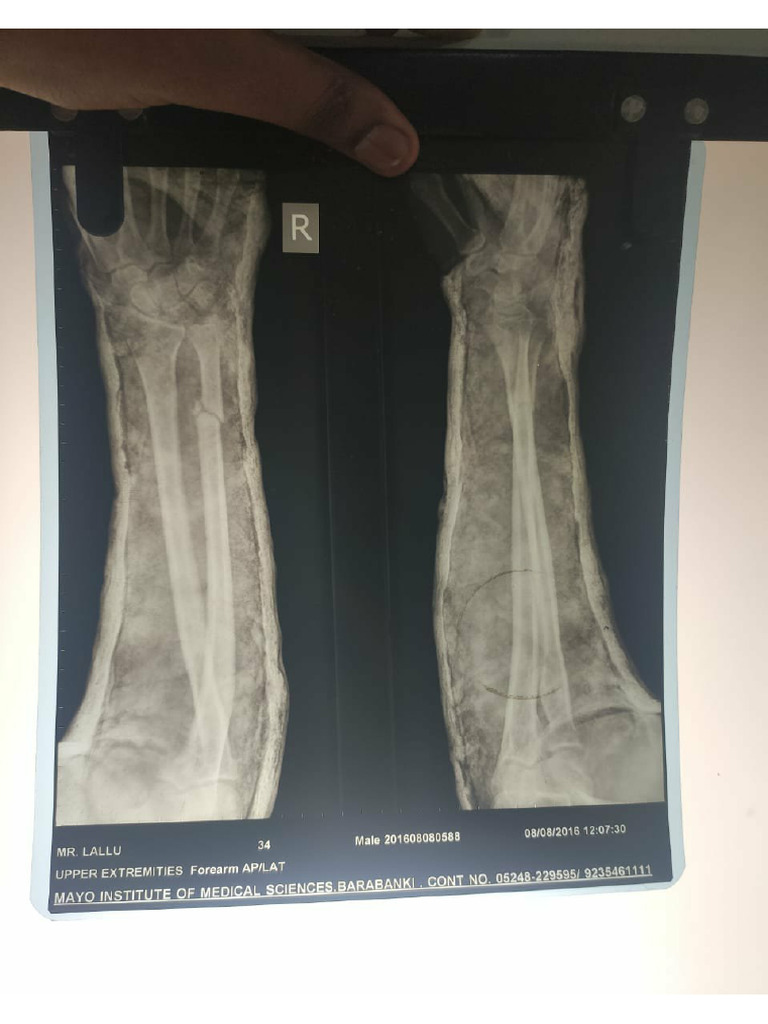 Surgery X Ray - 102947 | PDF