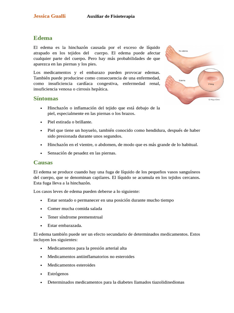 Edema, Linfedema e Inflamación: Causas y Síntomas | PDF | Edema ...