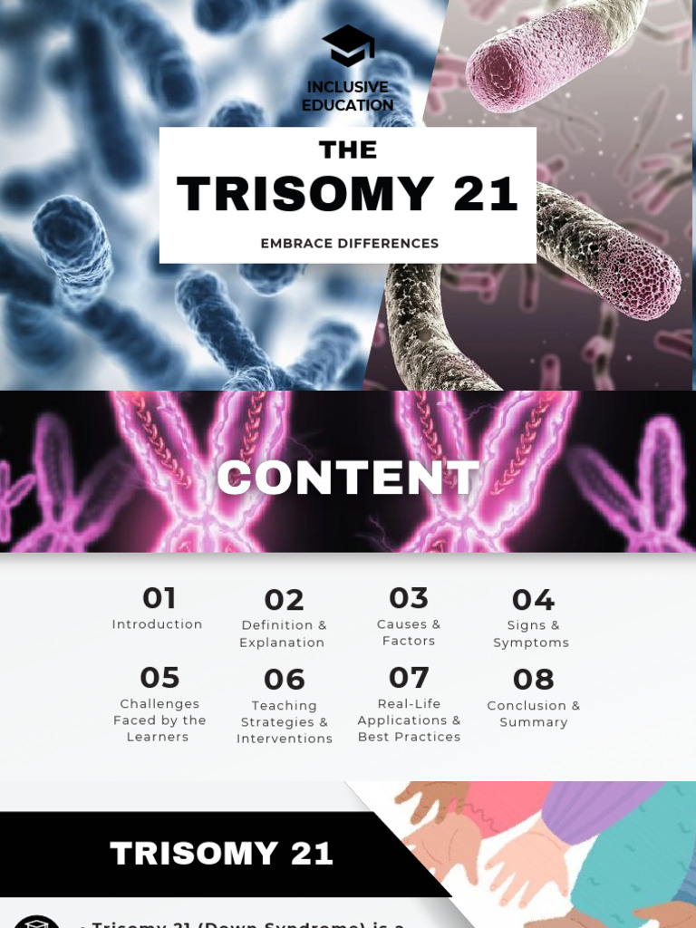 Trisomy 21 Down Syndrome | PDF | Down Syndrome | Learning