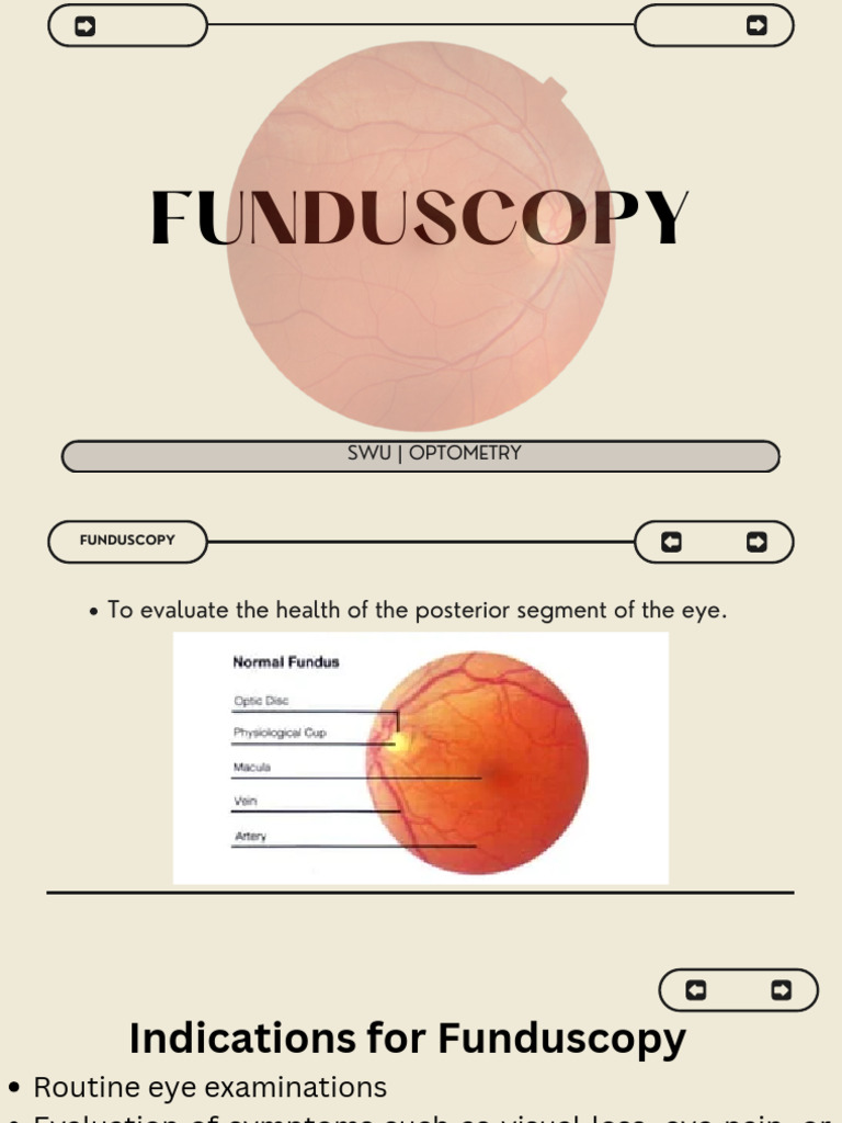 Funduscopy- | PDF | Retina | Human Eye
