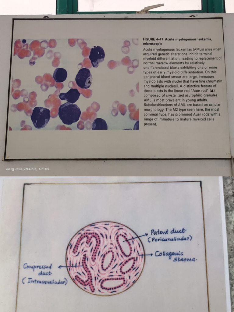 Patho Slides 2 | PDF