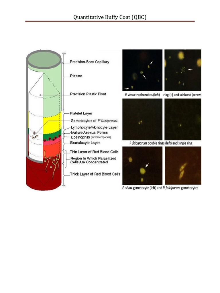 The QBC Test | PDF | Red Blood Cell | Staining