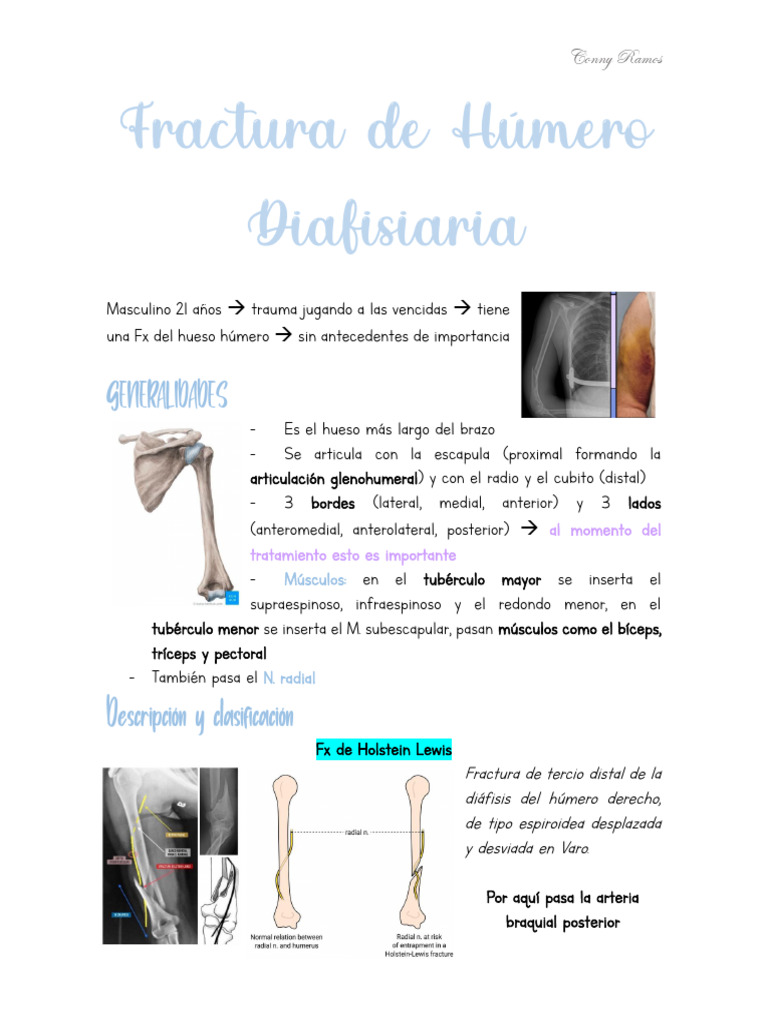 Fractura Diafisiaria de Húmero: Manejo y Rehabilitación | PDF ...