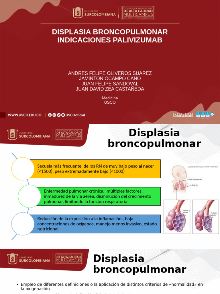 Displasia Broncopulmonar | PDF | Medicina CLINICA | Inmunología