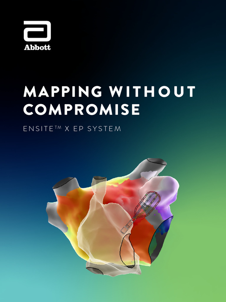 Ensite X Ep System Brochure Ex | PDF | Cardiovascular System | Cardiology