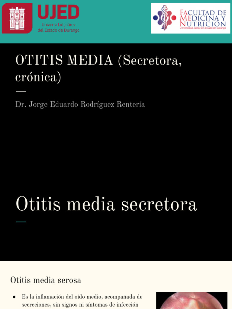 Otitis Media (Secretora y Cronica) | PDF | Oído | Sistema Auditorio