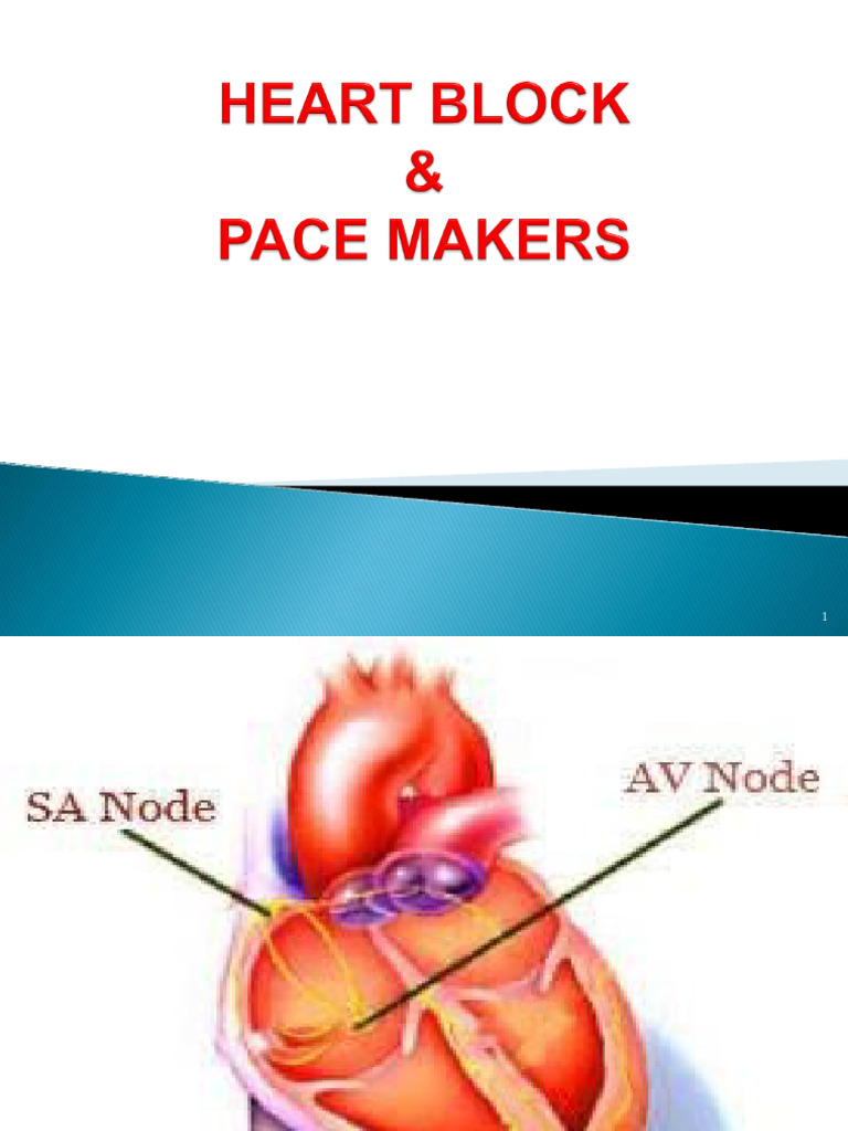 HEART Block class | PDF | Artificial Cardiac Pacemaker | Physiology